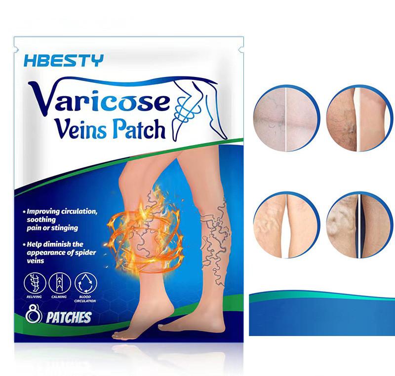 Пластырь от варикоза тромбоза и васкулита varicose veins patch 8 шт ...