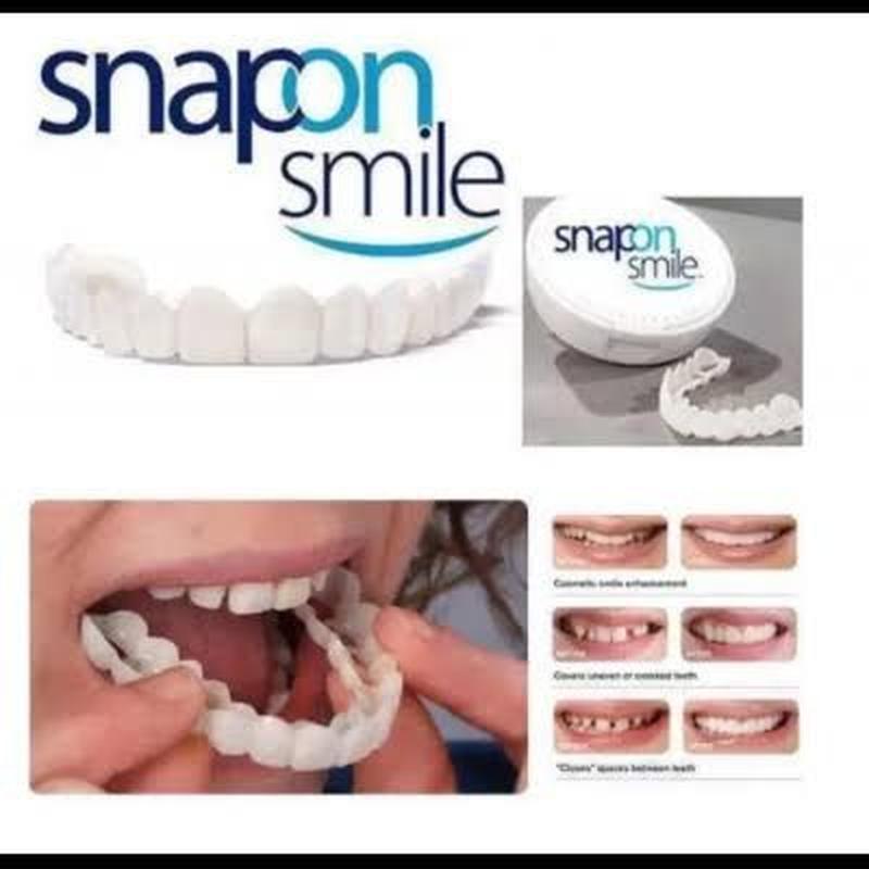 Знімні вініри на верхні та нижні щелепи Snap On Smile Veneers — цена